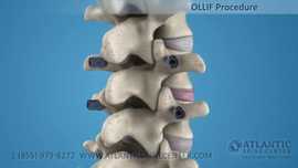 Spinal Care Video Library | Atlantic Spine Center