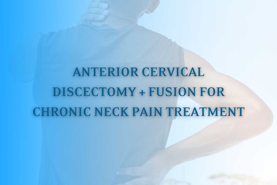 Anterior Cervical Discectomy and Fusion for Treating Chronic Neck Pain ...