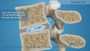 What Is a Bulging Disc? | Atlantic Spine Center
