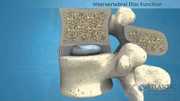 What Is a Normal Lumbar Disc and Facet Joint? | Atlantic Spine Center