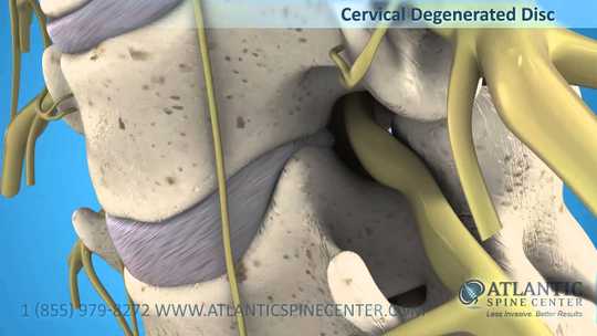 Spinal Care Video Library | Atlantic Spine Center